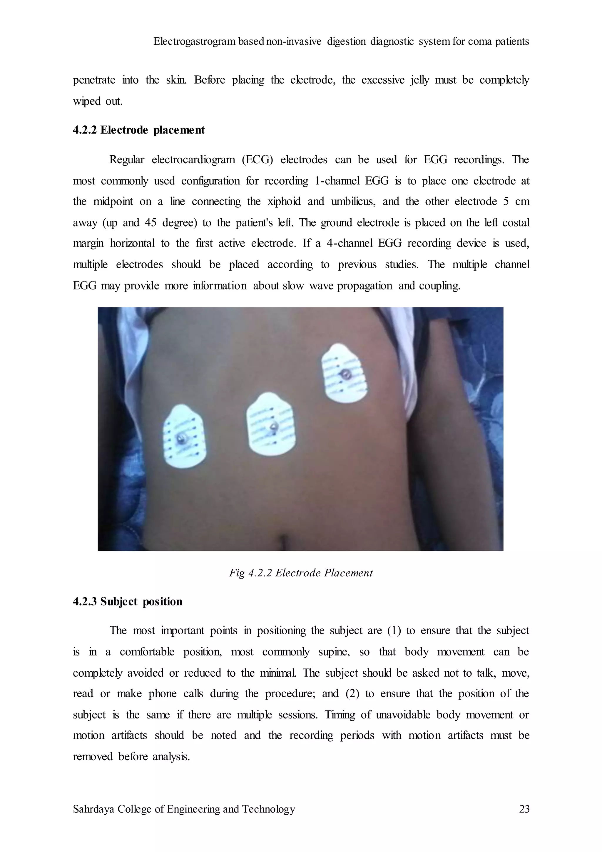 Electrogastrogram based digestion detection system for coma patients | DOCX