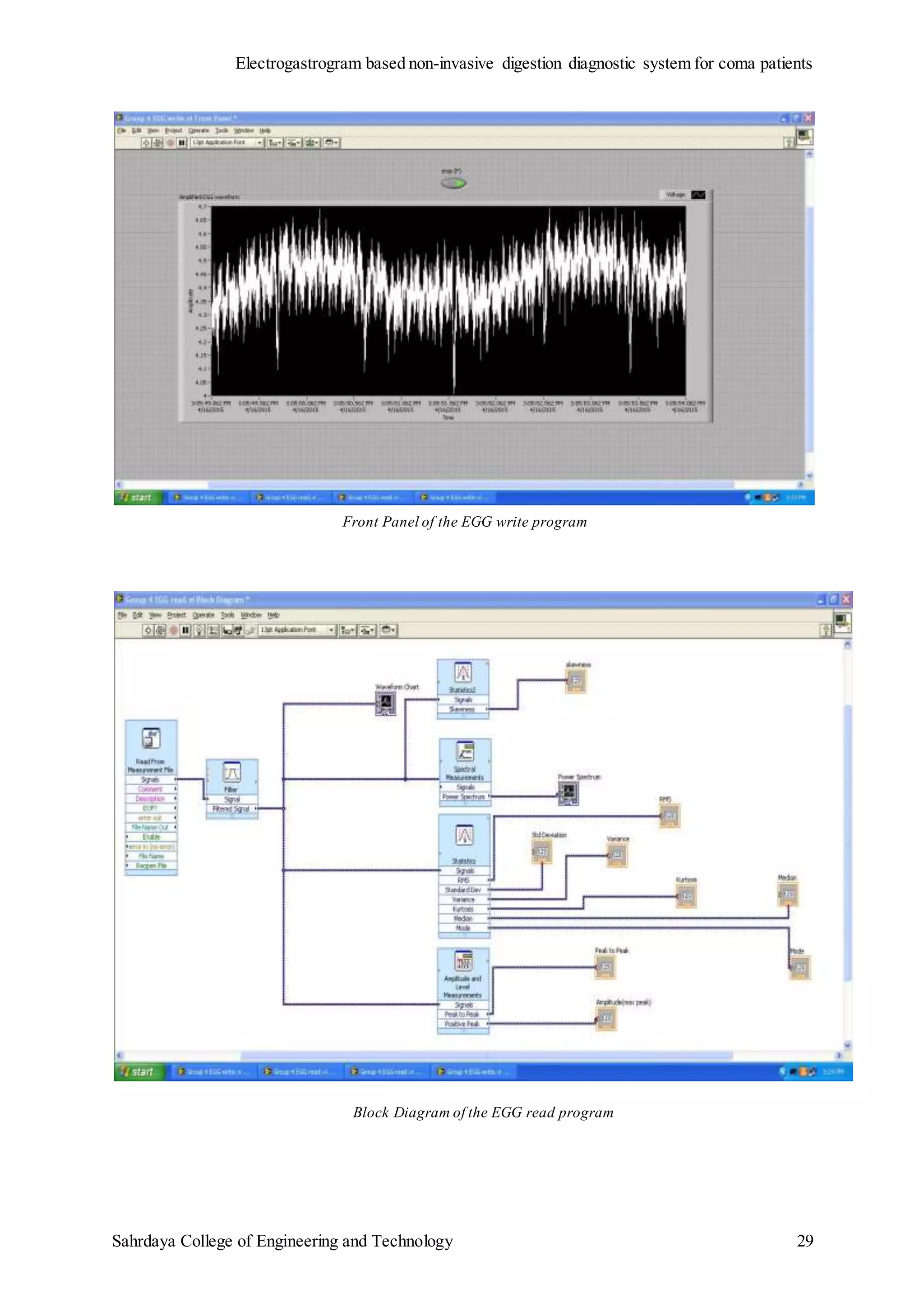 Electrogastrogram based digestion detection system for coma patients | DOCX