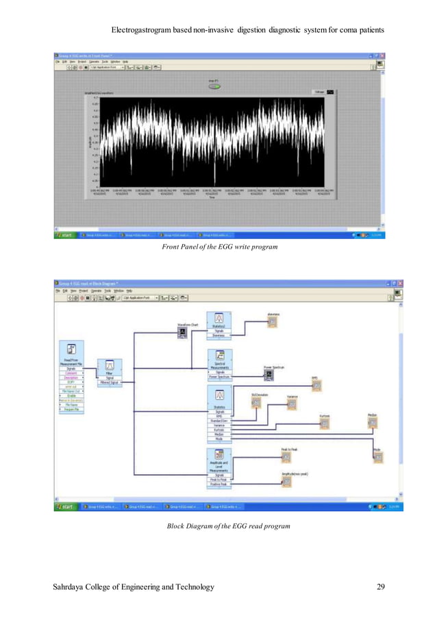 Electrogastrogram based digestion detection system for coma patients | DOCX