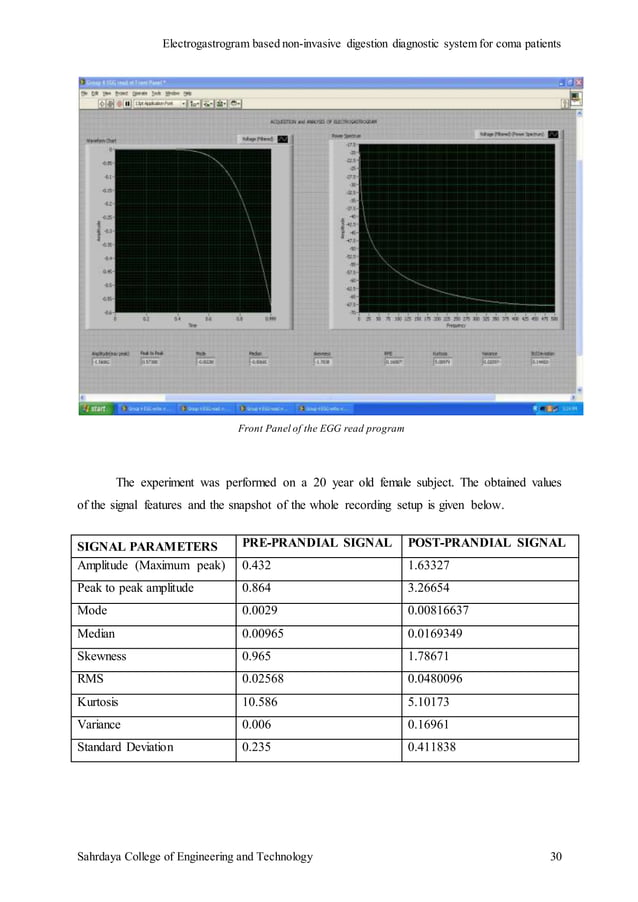 Electrogastrogram based digestion detection system for coma patients | DOCX