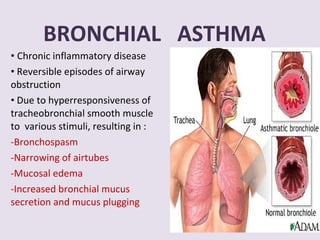 19.bronchial asthma | PPT