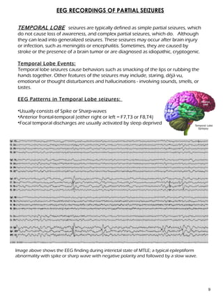EEG & Epilepsy syndromes report [Autosaved] | PPT