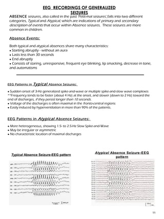EEG & Epilepsy syndromes report [Autosaved] | PPT | Brain and Nervous ...