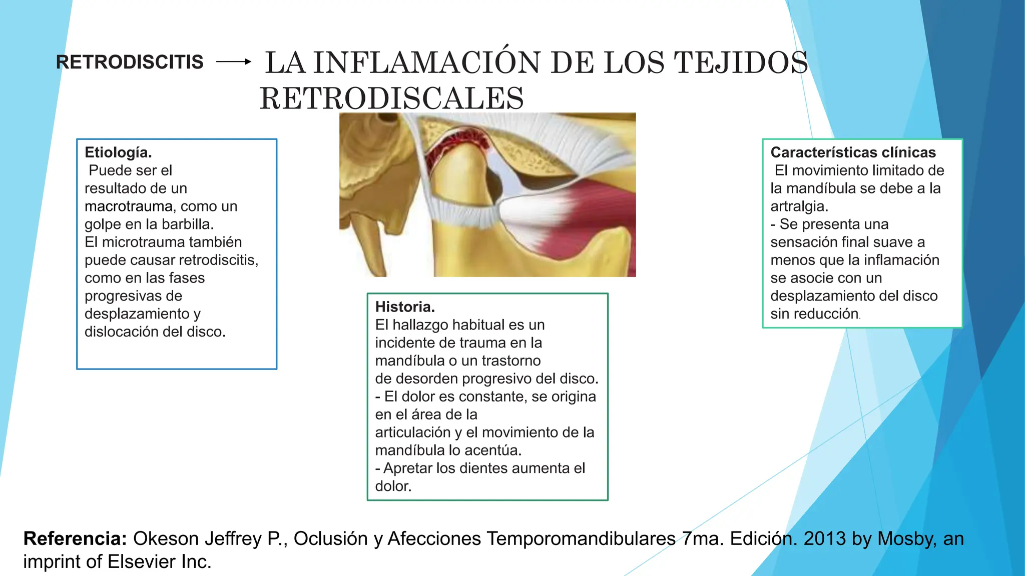 Trastornos temporomandibulares (seminario) | PPTX