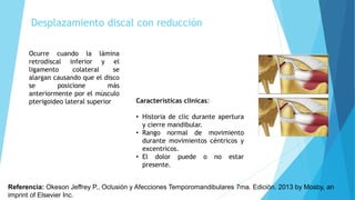 Trastornos temporomandibulares (seminario) | PPTX