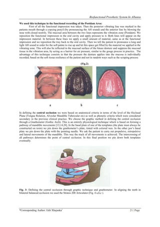 Biofunctional Prosthetic System in Albania | PDF