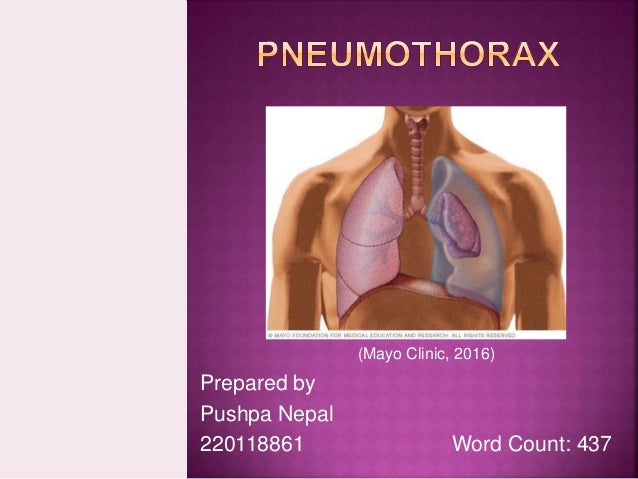 Pneumothorax ppt 368 final....