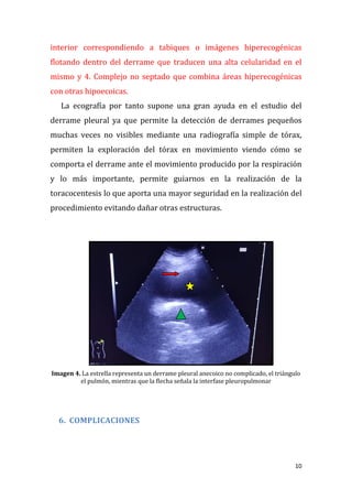 E3a. Toracocentesis | PDF