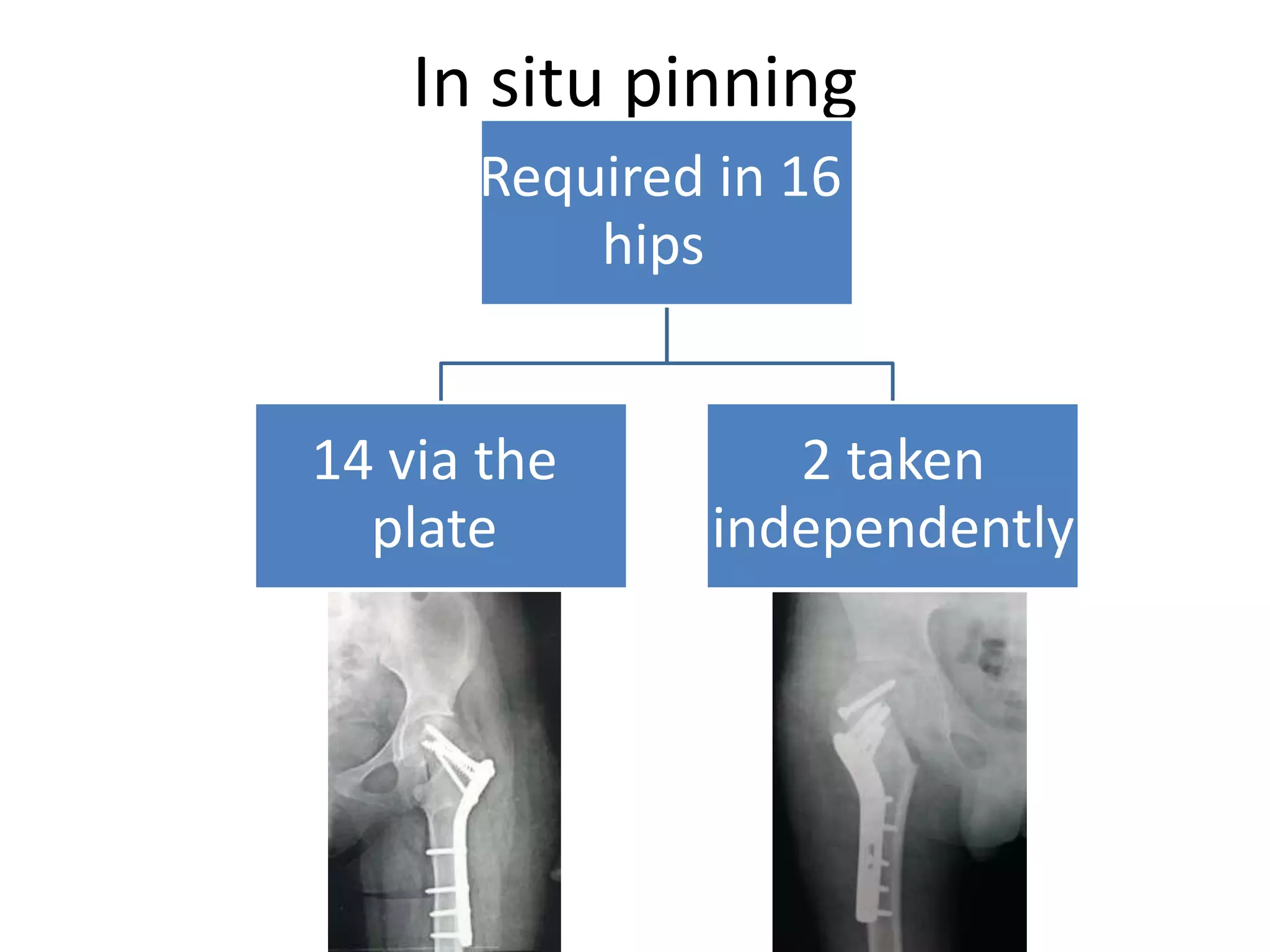 Short term outcomes of Intertrochanteric Imhauser Osteotomy combined ...