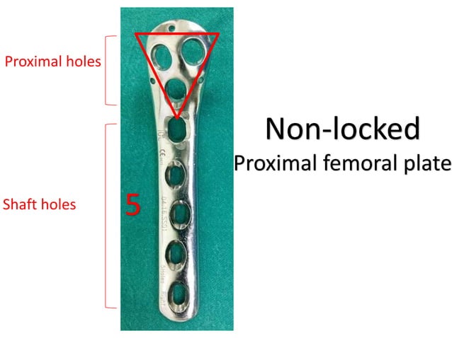 Short term outcomes of Intertrochanteric Imhauser Osteotomy combined ...