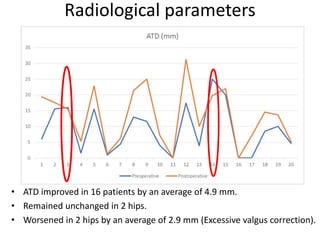 Short term outcomes of Intertrochanteric Imhauser Osteotomy combined ...