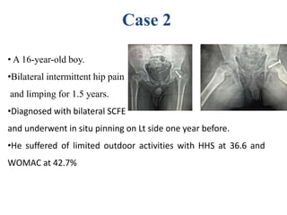 Short term outcomes of Intertrochanteric Imhauser Osteotomy combined ...