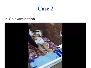 Short term outcomes of Intertrochanteric Imhauser Osteotomy combined ...