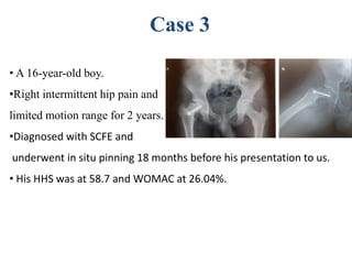Short term outcomes of Intertrochanteric Imhauser Osteotomy combined ...