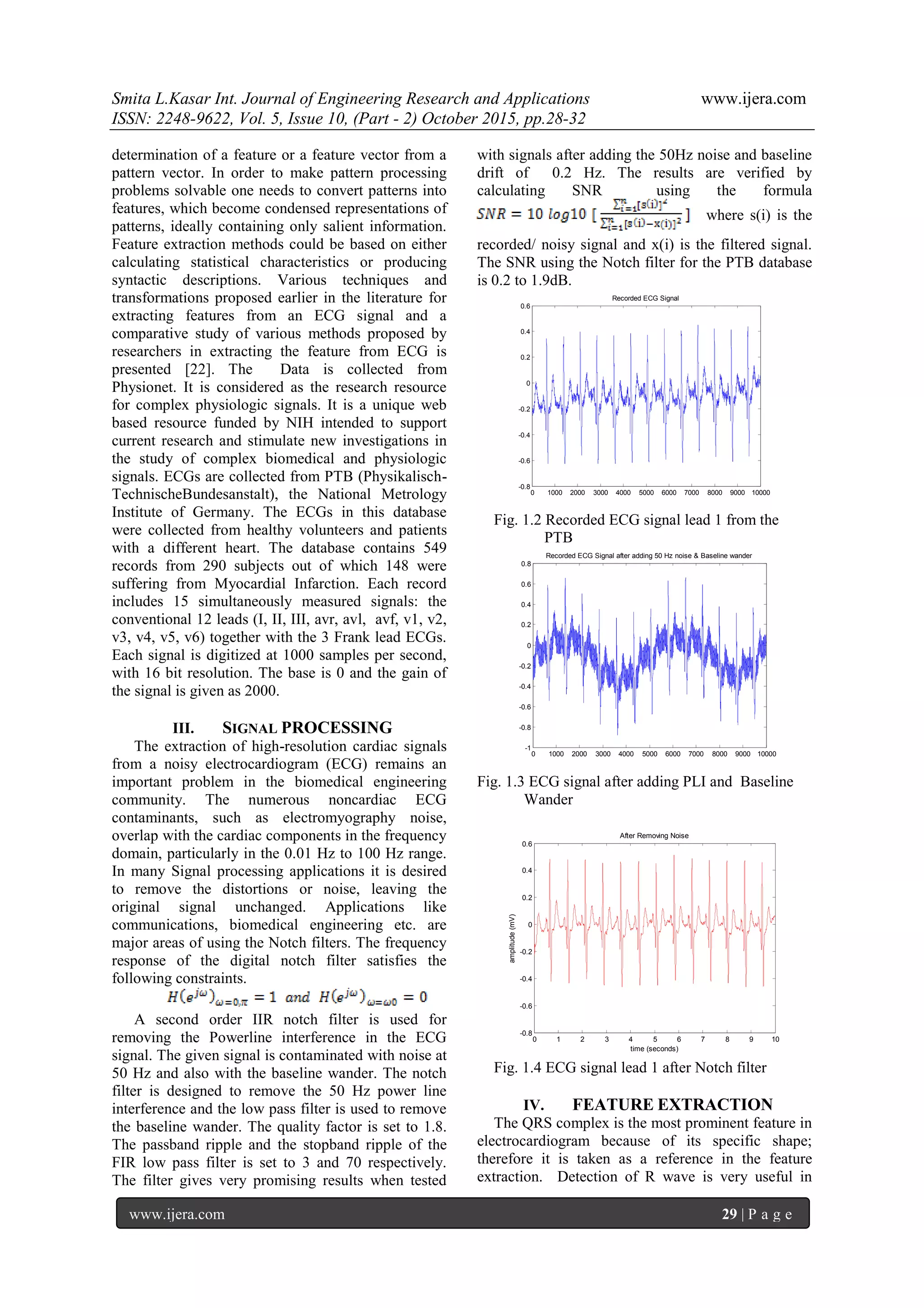 Identification Of Myocardial Infarction From Multi Lead Ecg Signal Pdf