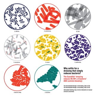 GuardIVa Brochure | PDF