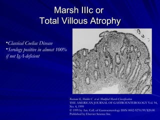 E5dc Coeliac Disease, Worcester University | PPT