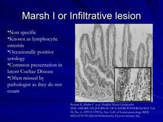 E5dc Coeliac Disease, Worcester University | PPT