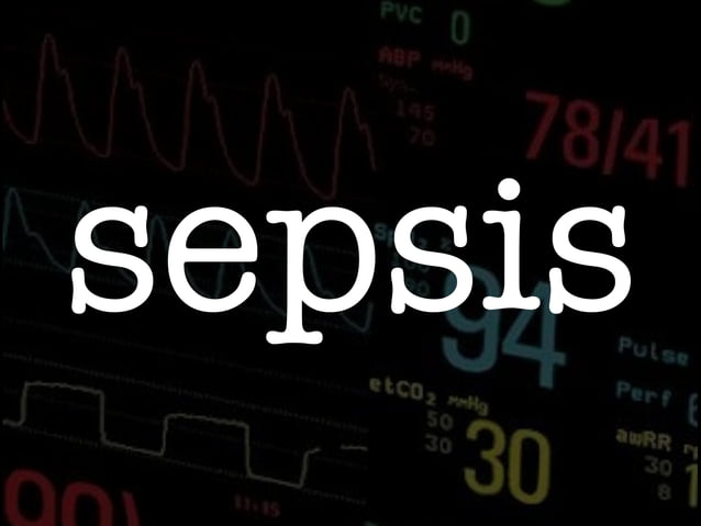 MMUH ICU ED teaching sepsis | PPT