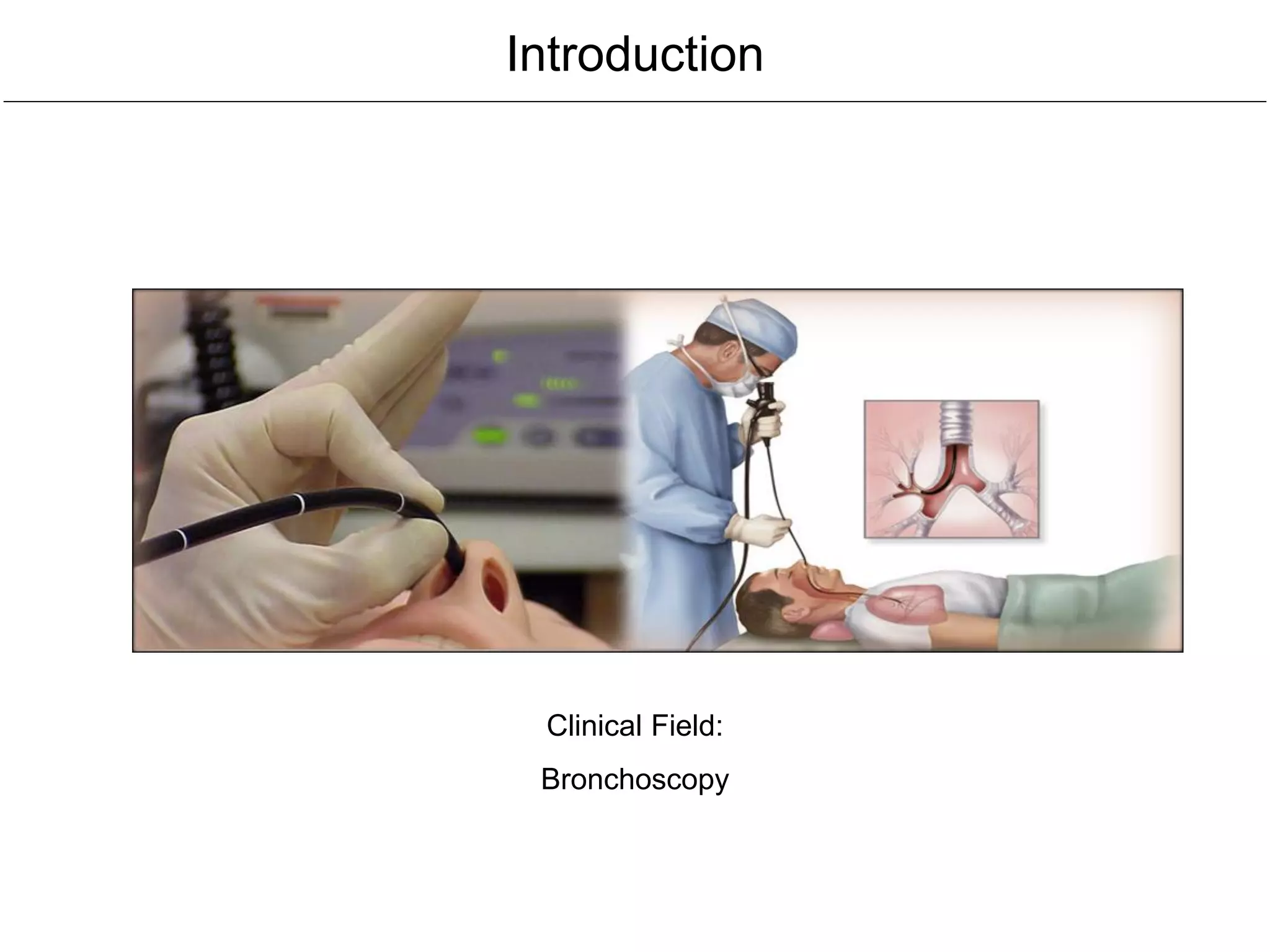 IGS_final_presentation_bronchoscopy | PDF | Lung and Respiratory Health ...