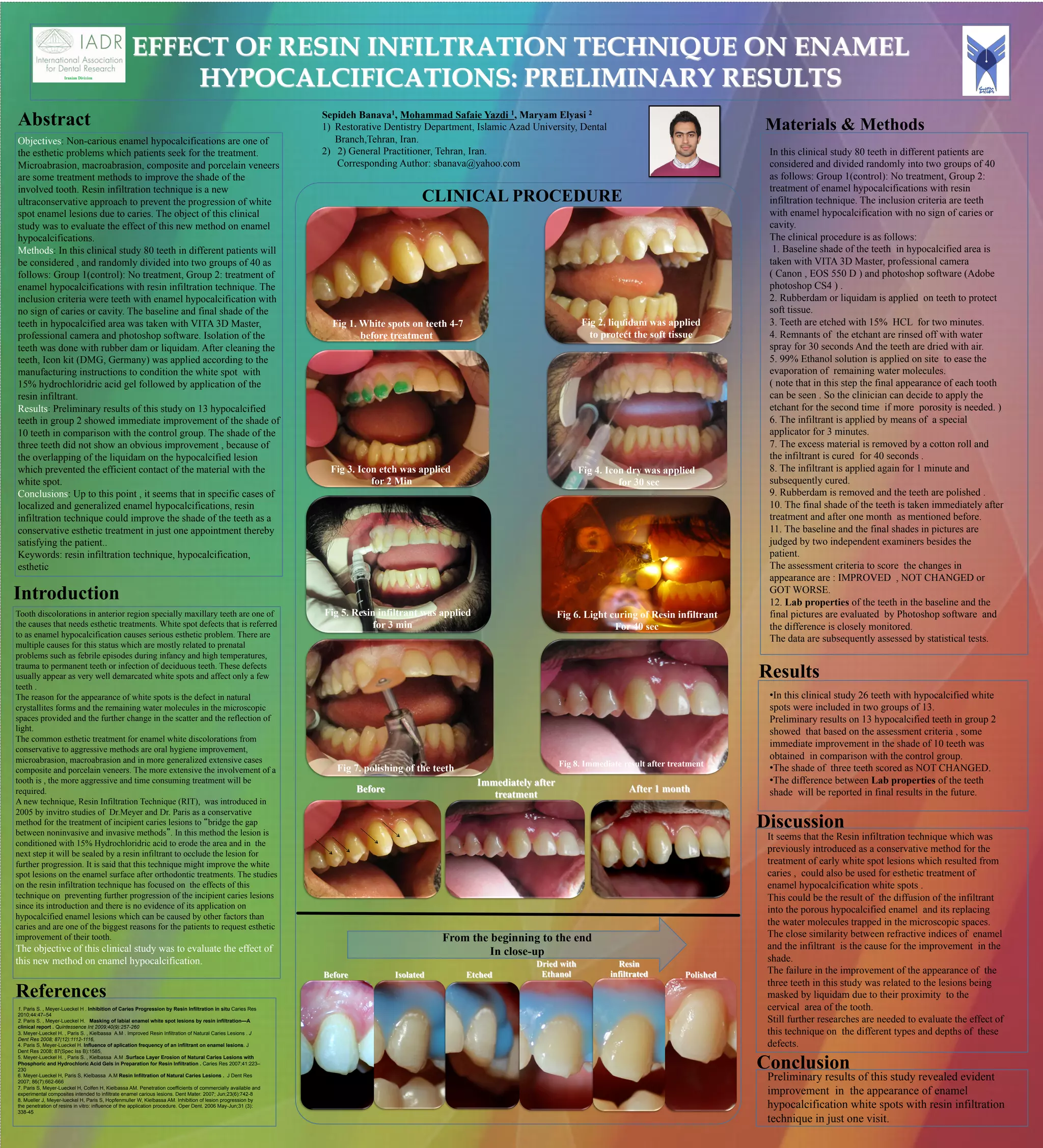 Resin Infiltration Poster English | PDF
