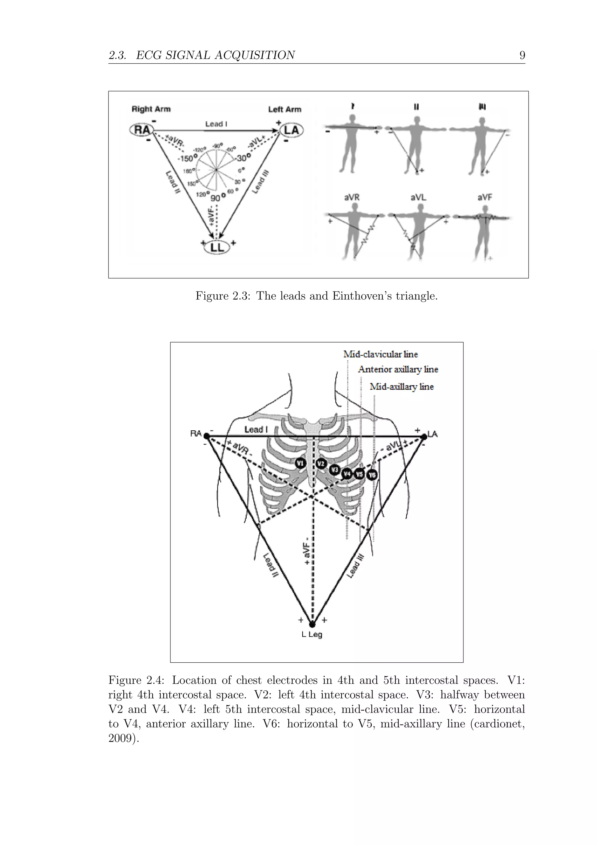 Analysis And Classification Of Ecg Signal Using Neural Network Pdf