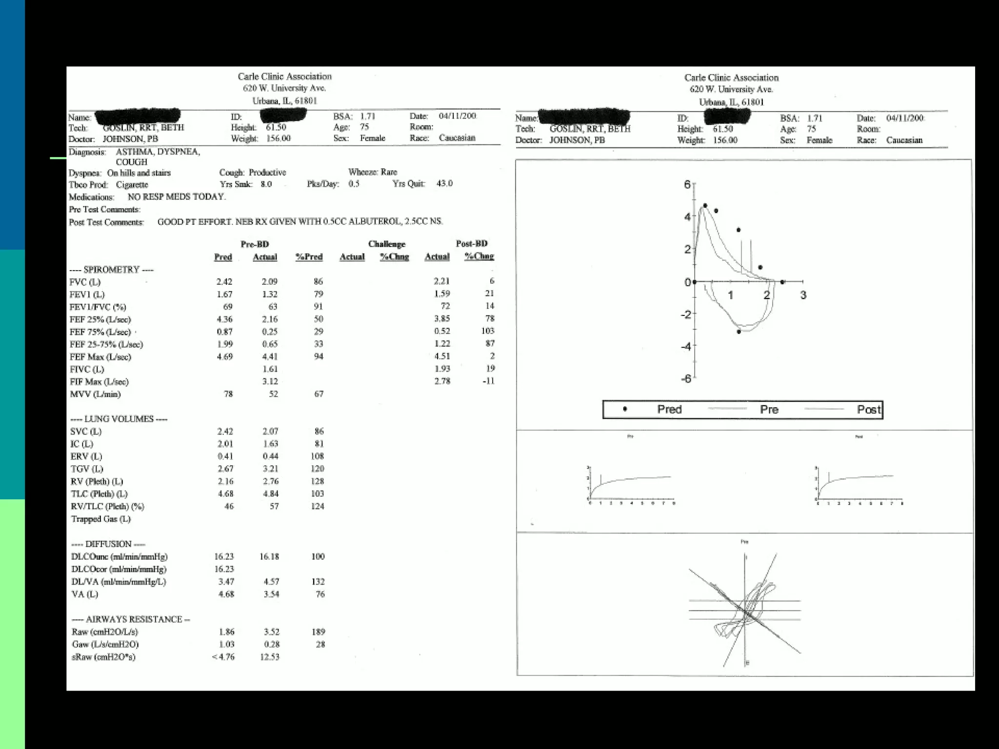 Pulmonary Function Testing Ppt