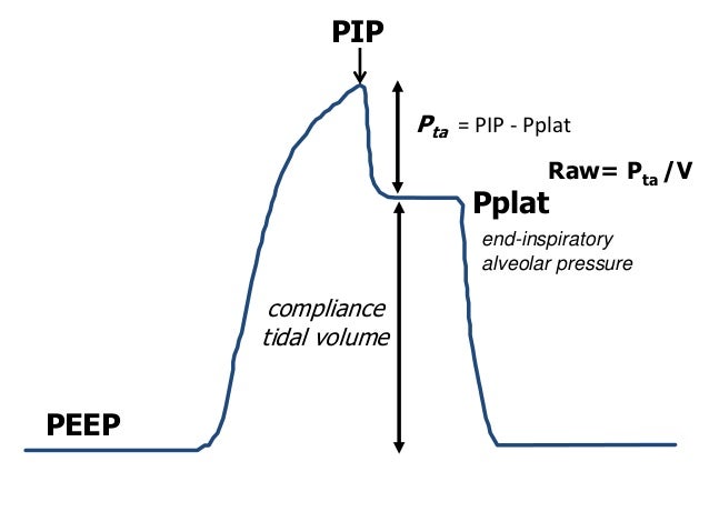 Monitoring of Mechanical Ventilation by OluAlbert