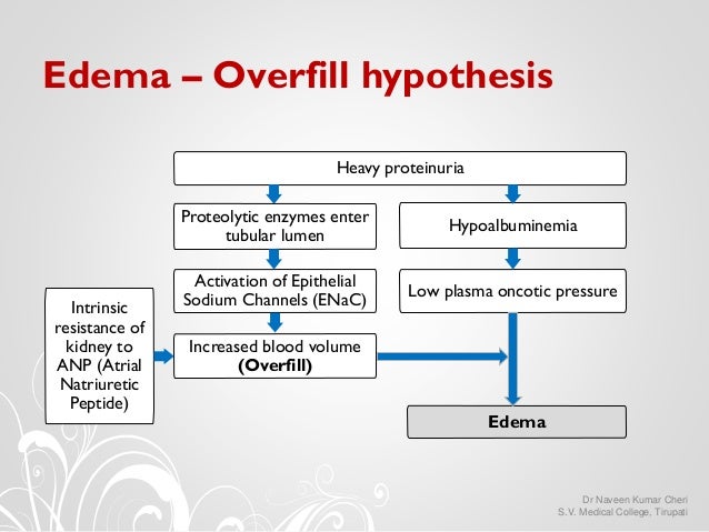 Management Of Nephrotic Syndrome