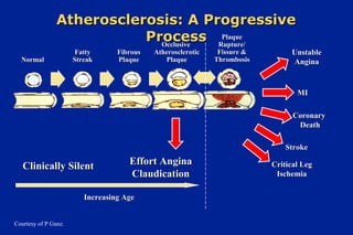 Atherosclerosis Process