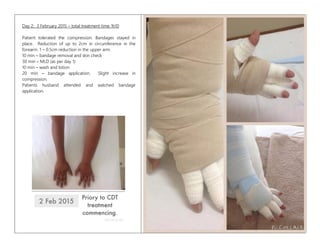 Pilot Case Study in Mauritius for the Treatment of Lymphedema using ...
