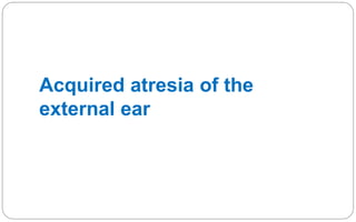External auditory canal anatomy pathologies & management | PPTX