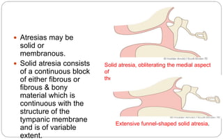 External auditory canal anatomy pathologies & management | PPTX