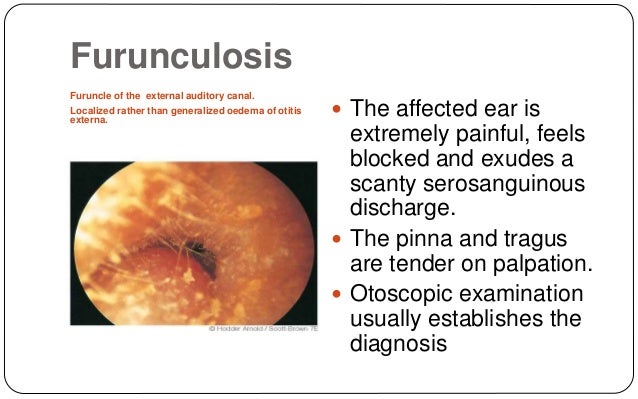 External auditory canal anatomy pathologies & management