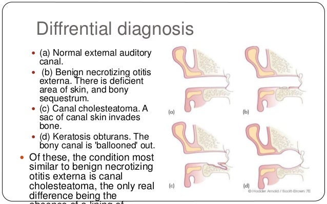 External auditory canal anatomy pathologies & management