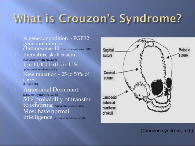 Crouzon’s Syndrome