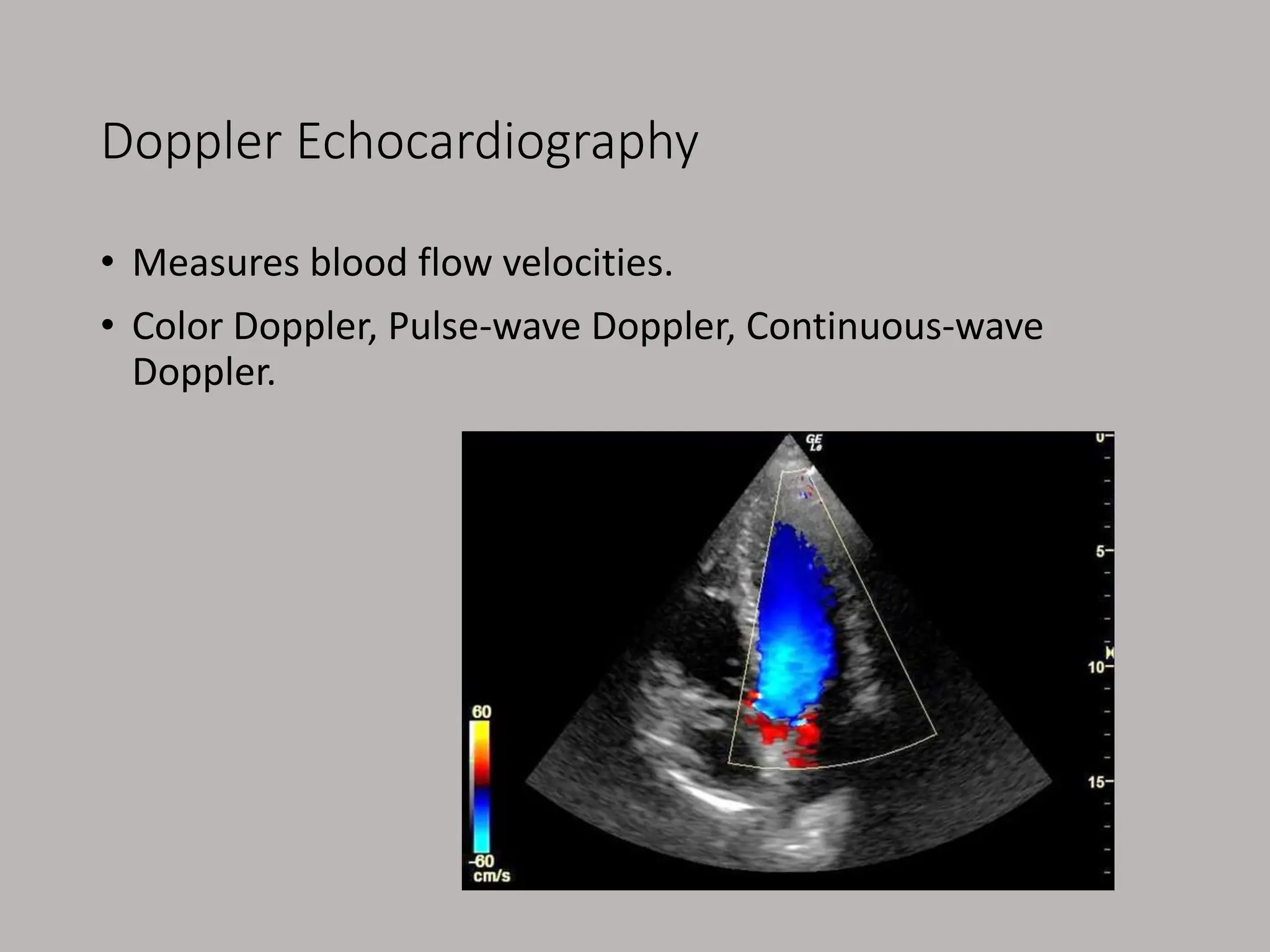 how to read echocardiography of heart.pptx