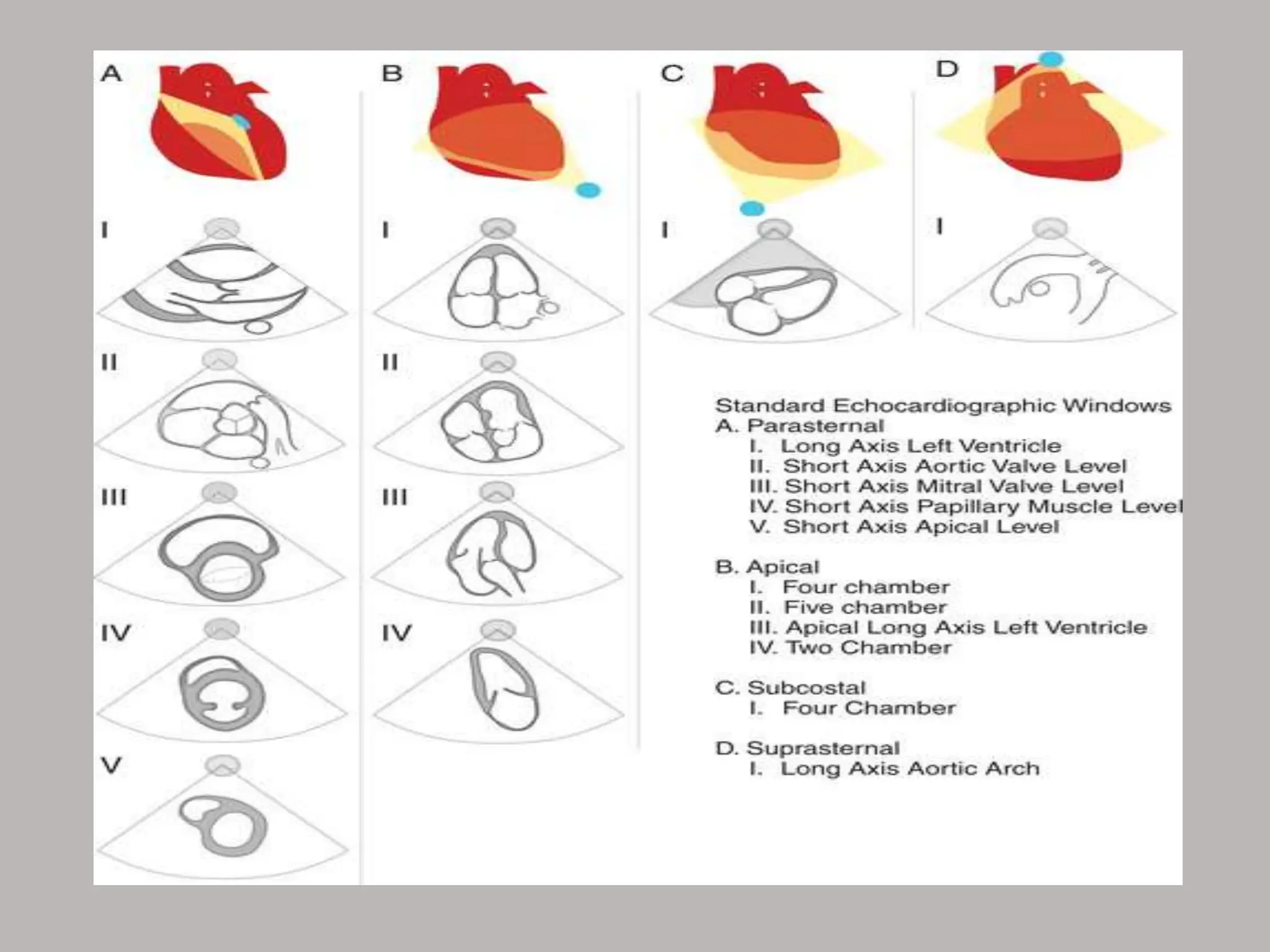 how to read echocardiography of heart.pptx
