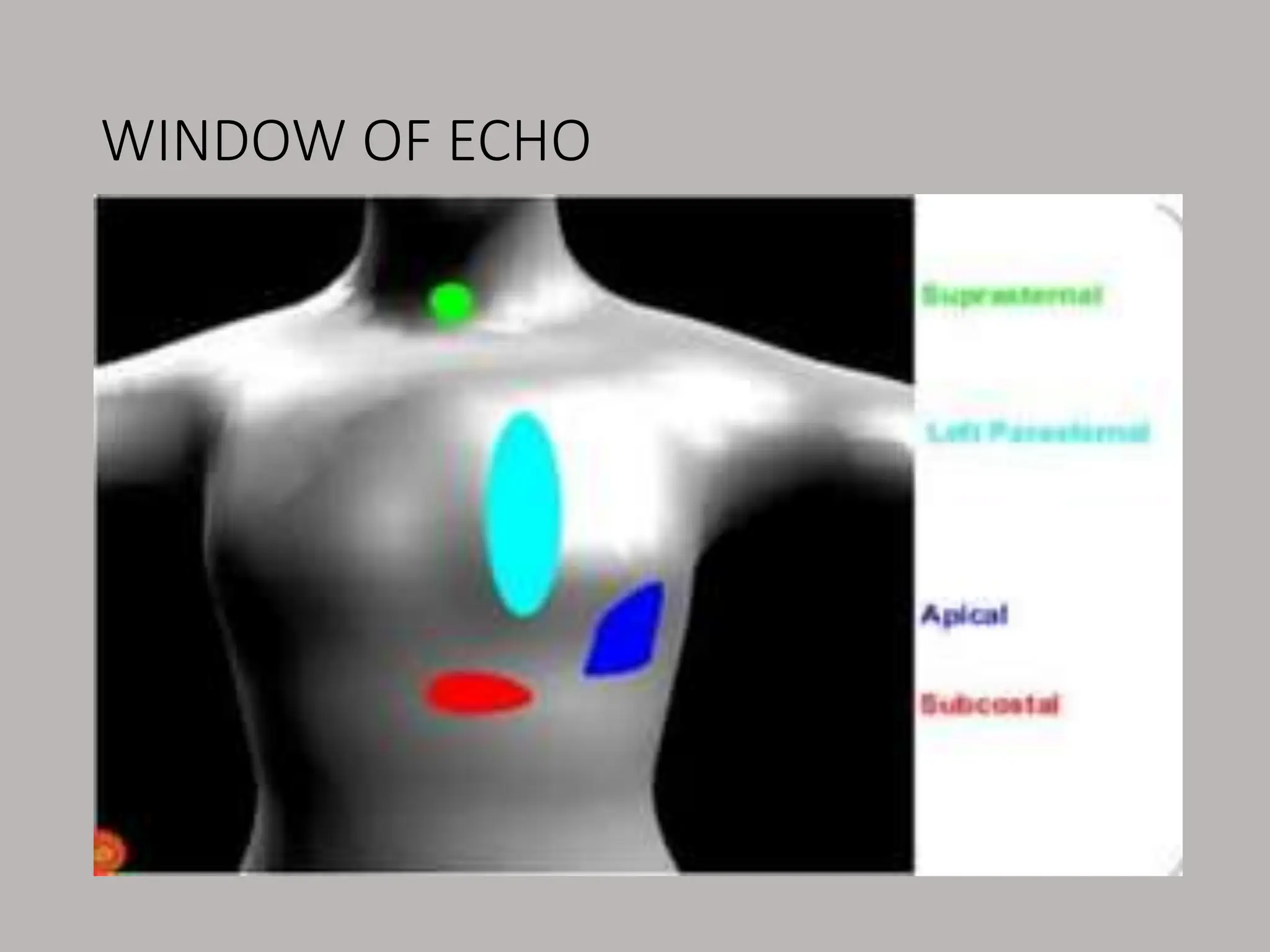 how to read echocardiography of heart.pptx