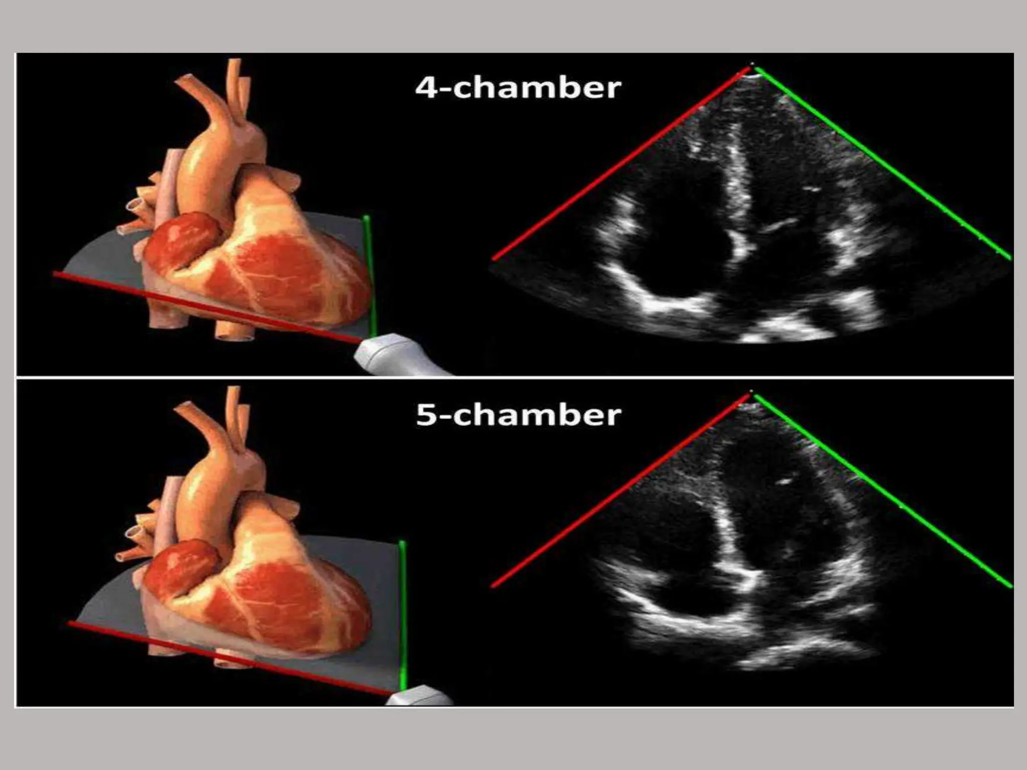 how to read echocardiography of heart.pptx