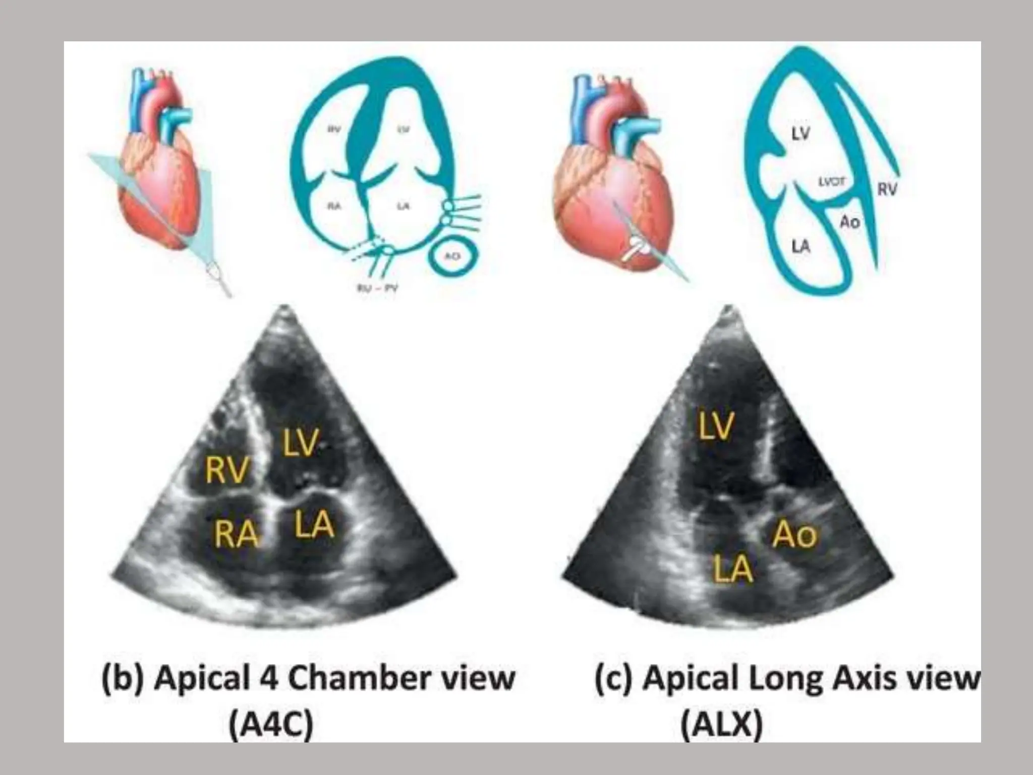 how to read echocardiography of heart.pptx