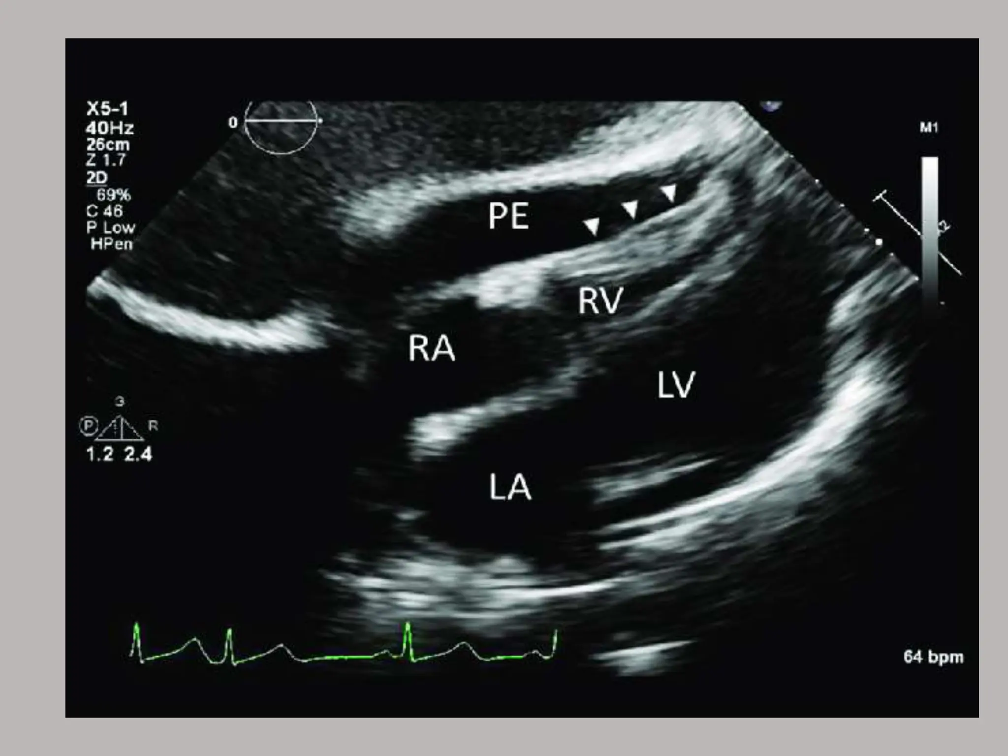 how to read echocardiography of heart.pptx