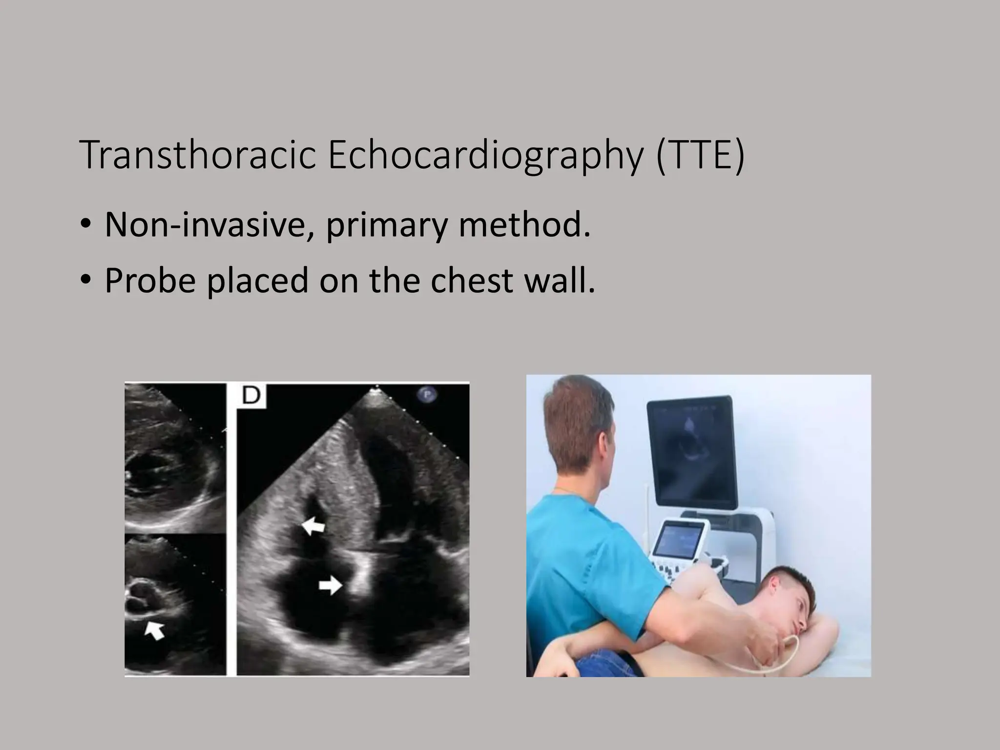 how to read echocardiography of heart.pptx