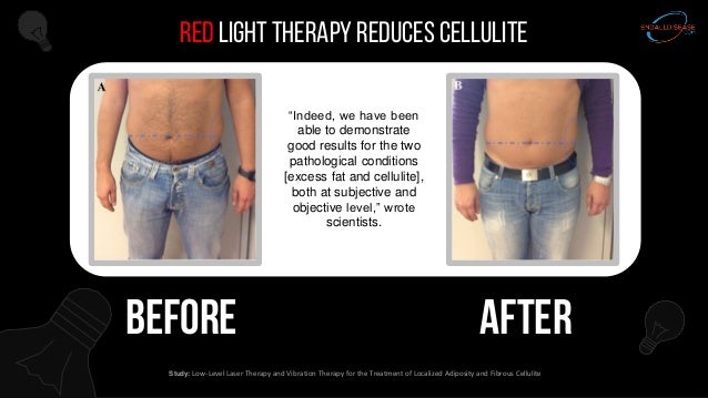 Rejuvenate Your Skin With Red Light Therapy - Before and After Pictur…