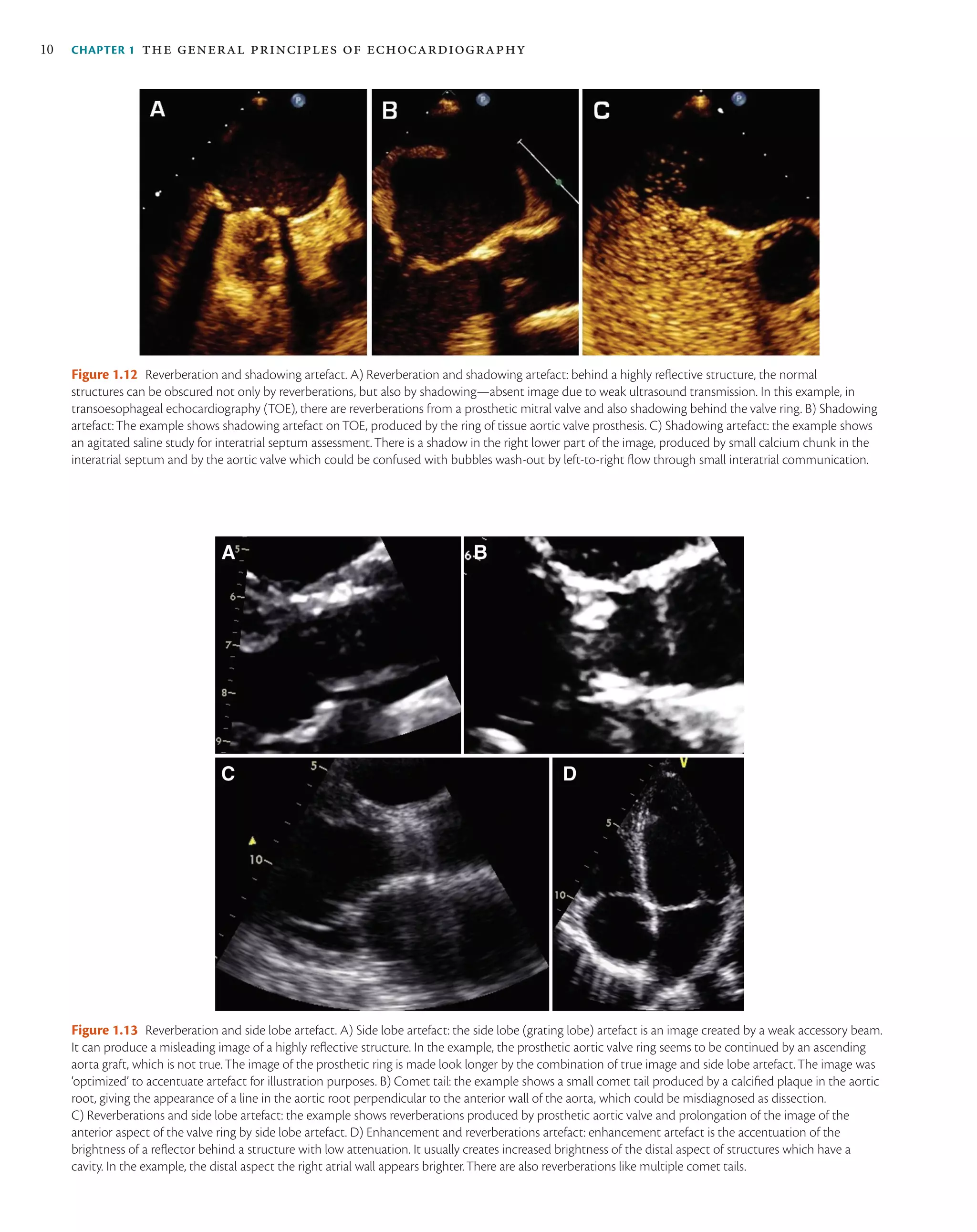 EAE Textbook of Echocardiography - sample | PDF