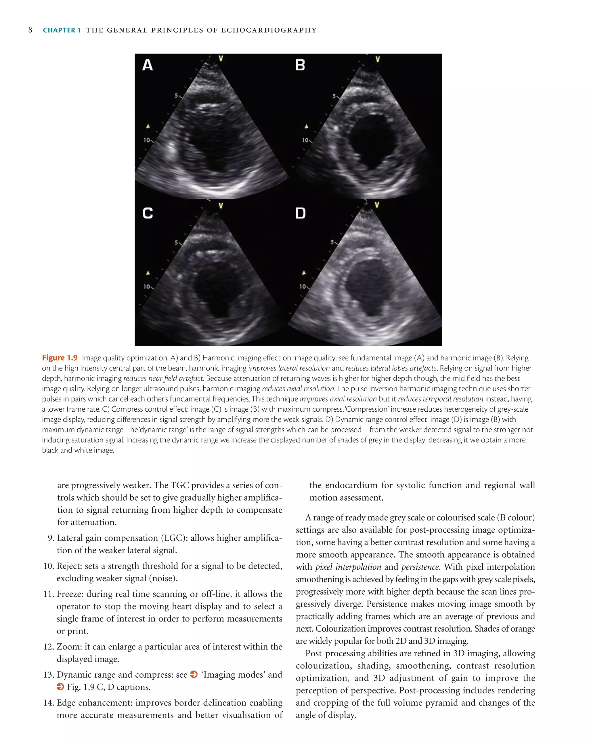 EAE Textbook of Echocardiography - sample | PDF