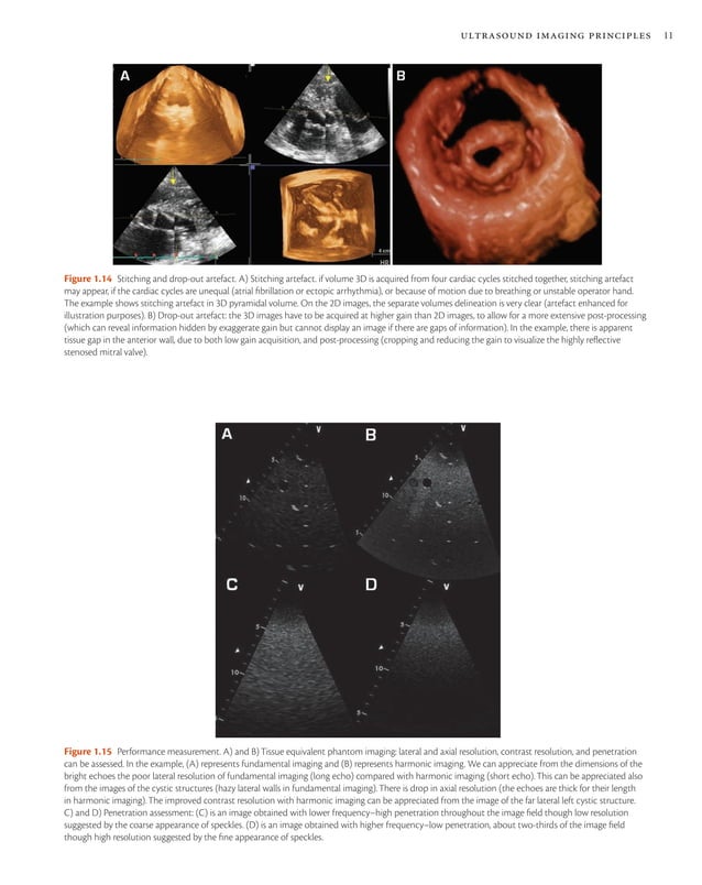 EAE Textbook of Echocardiography - sample | PDF