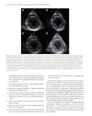 EAE Textbook of Echocardiography - sample | PDF
