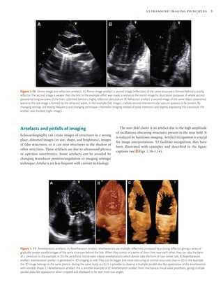 EAE Textbook of Echocardiography - sample | PDF