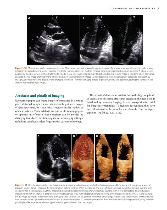 EAE Textbook of Echocardiography - sample | PDF